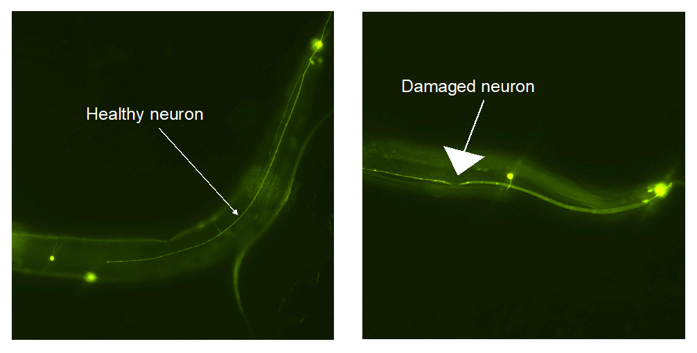 Snapshot: What are Caenorhabditis elegans models? - National Ataxia ...