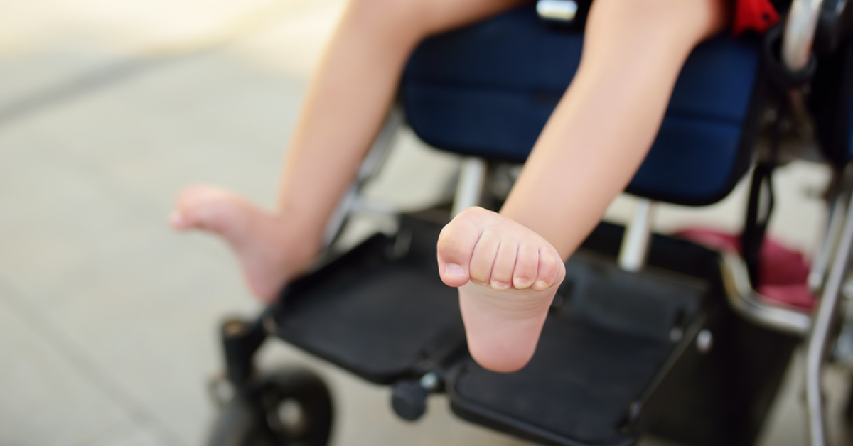 Snapshot: What is Spasticity? - National Ataxia Foundation